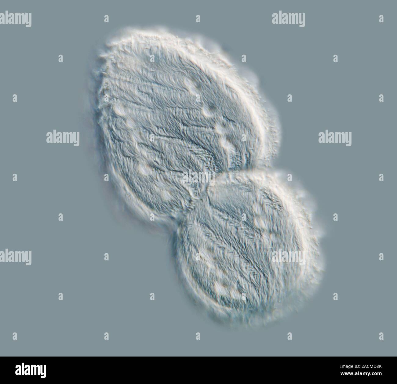 Parasitic protozoan. Differential interference contrast micrograph of a ...