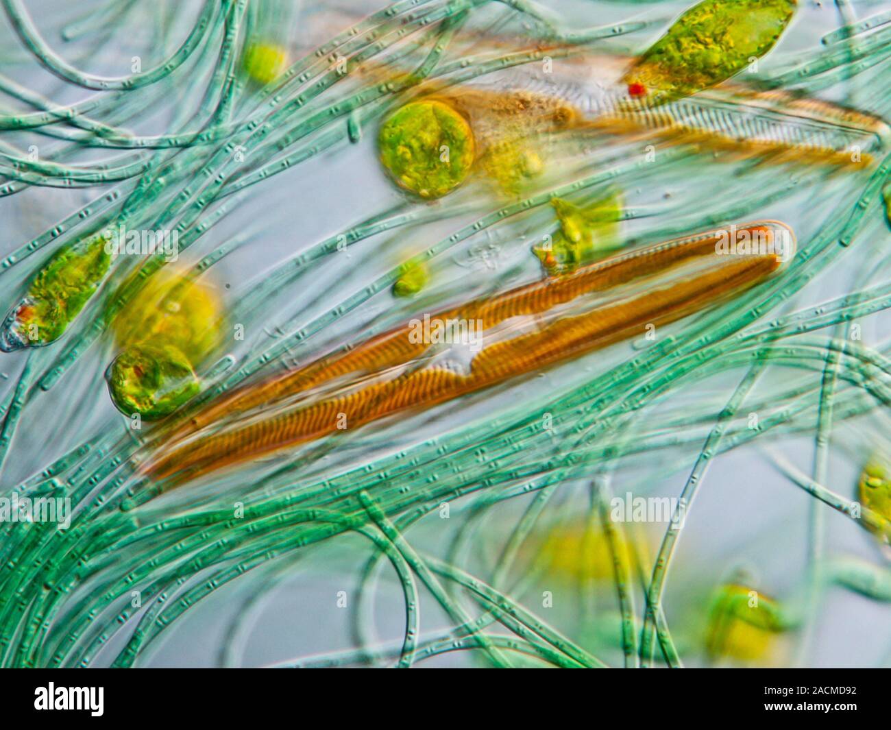 Algae. Differential interference contrast micrograph of a sample of ...