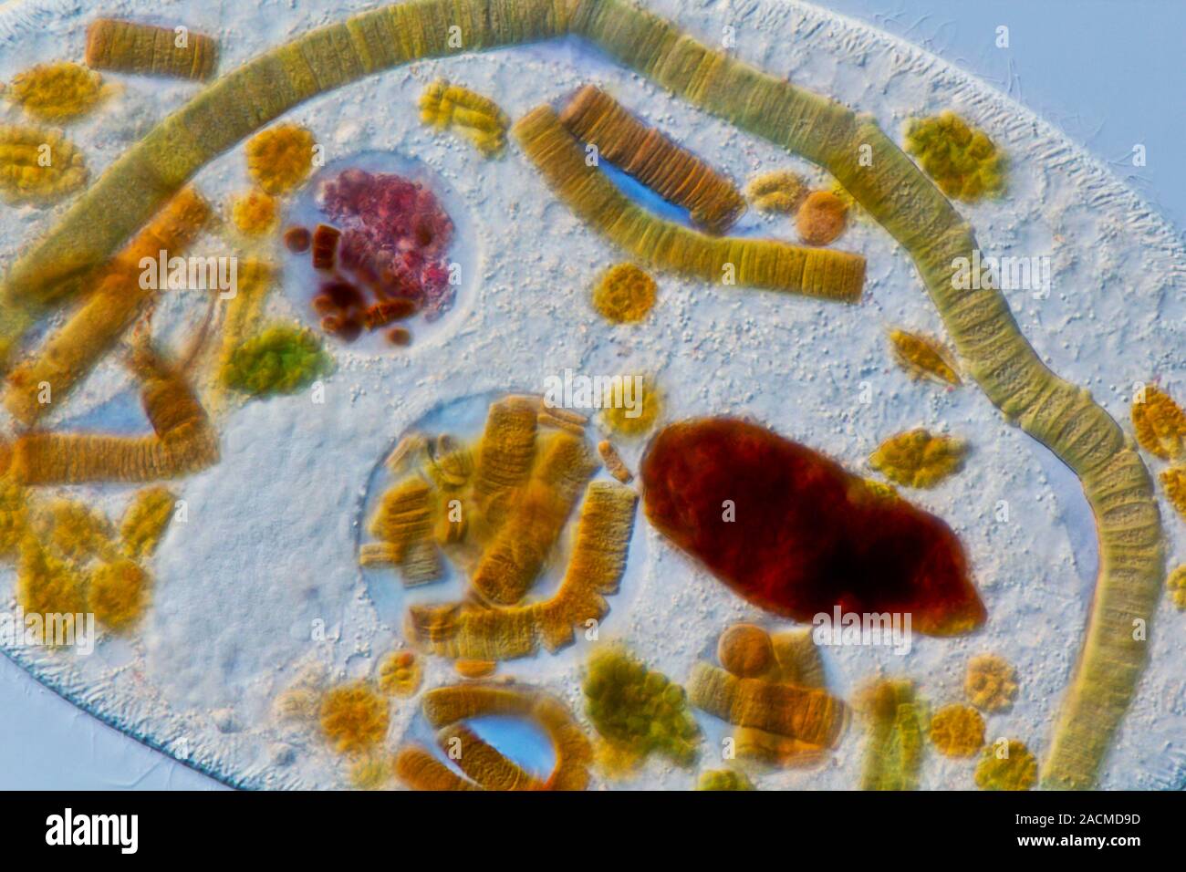 Frontonia protist. Differential interference contrast micrograph of the ...