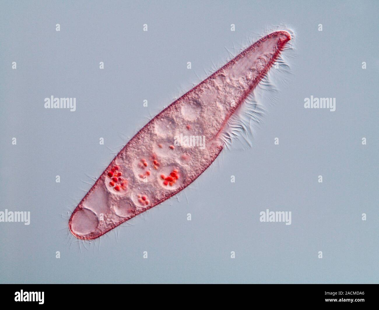 Blepharisma protozoan. Differential interference contrast micrograph of ...