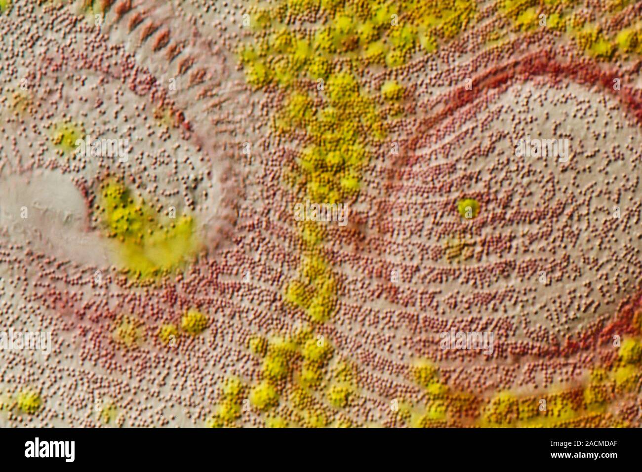 Ciliate protozoan. Differential interference contrast micrograph of a ...