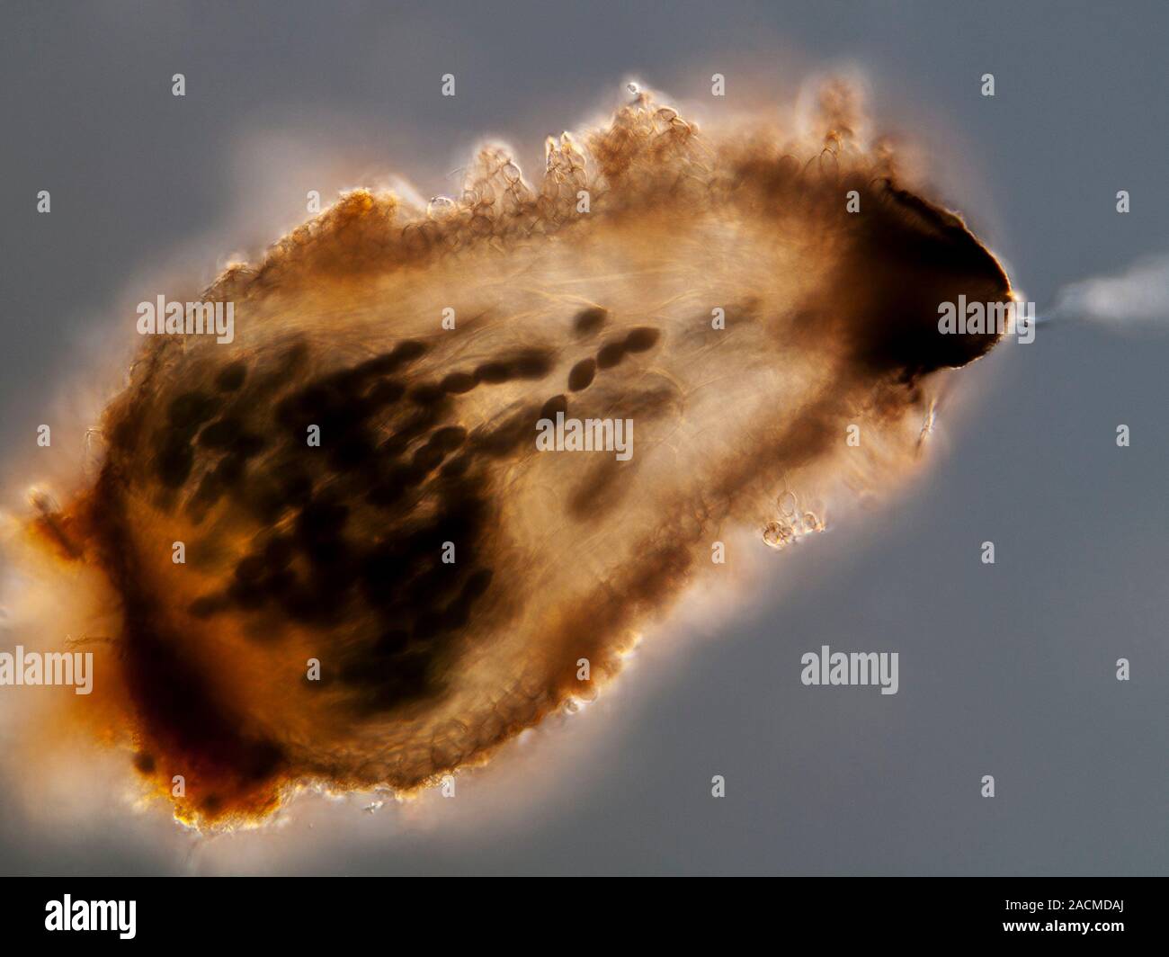 Schizothecium fungus. Differential interference contrast micrograph of ...