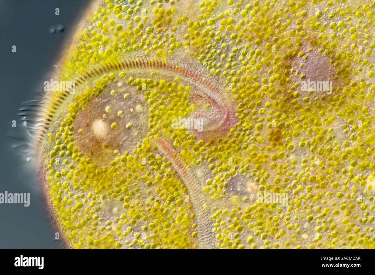 Ciliate protozoan. Differential interference contrast micrograph of a ...