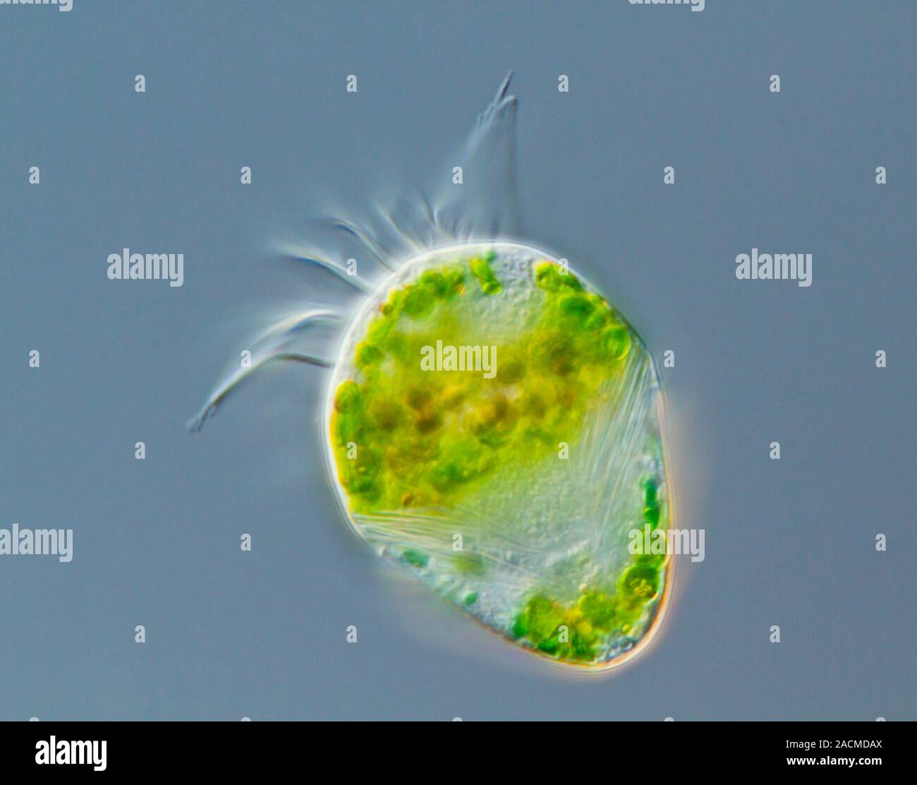 Ciliate protozoan. Differential interference contrast micrograph of a ...
