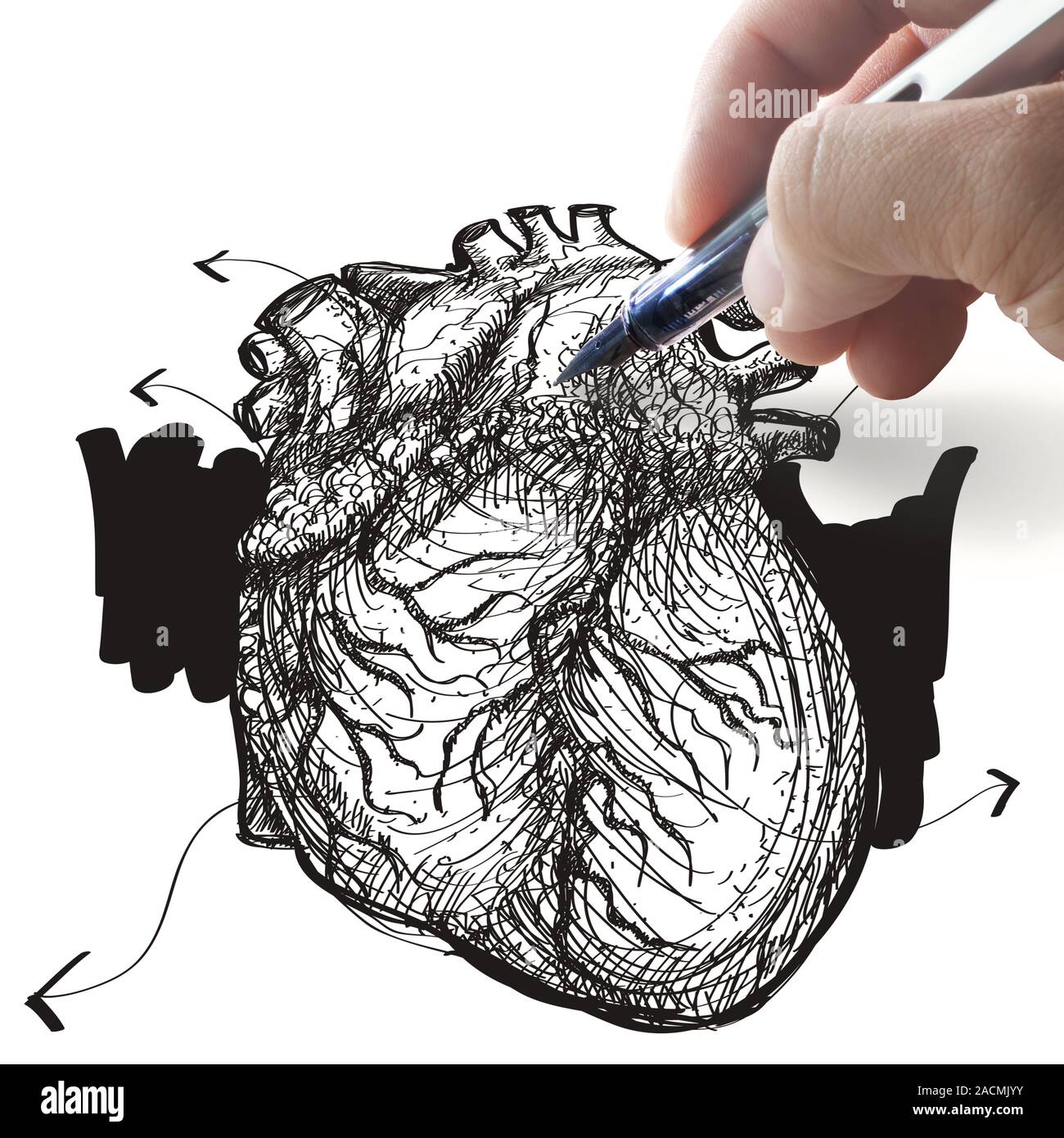 Heart attack drawing hi-res stock photography and images - Alamy