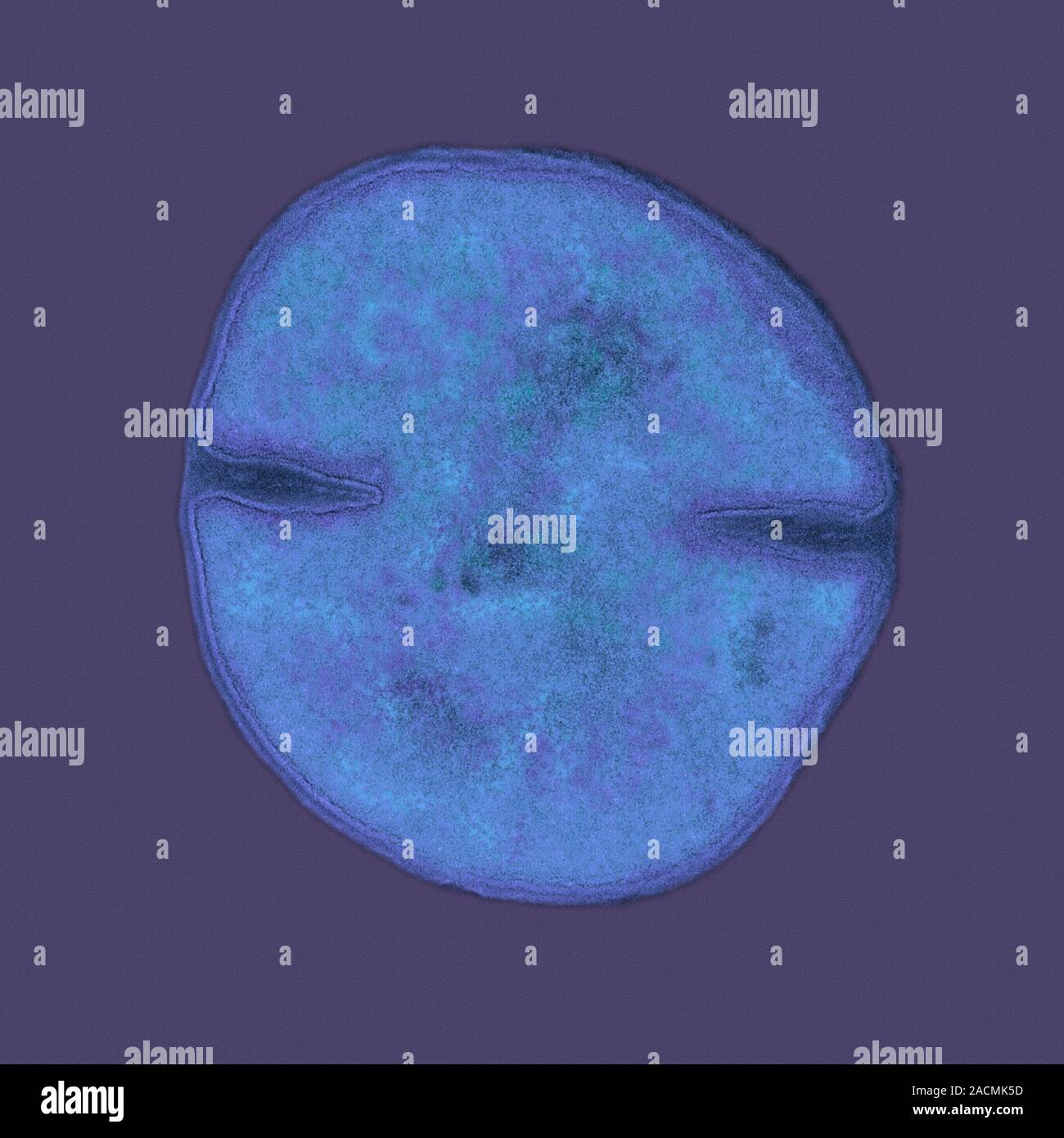 Staphylococcus aureus Bacteria. TEM Stock Photo - Alamy