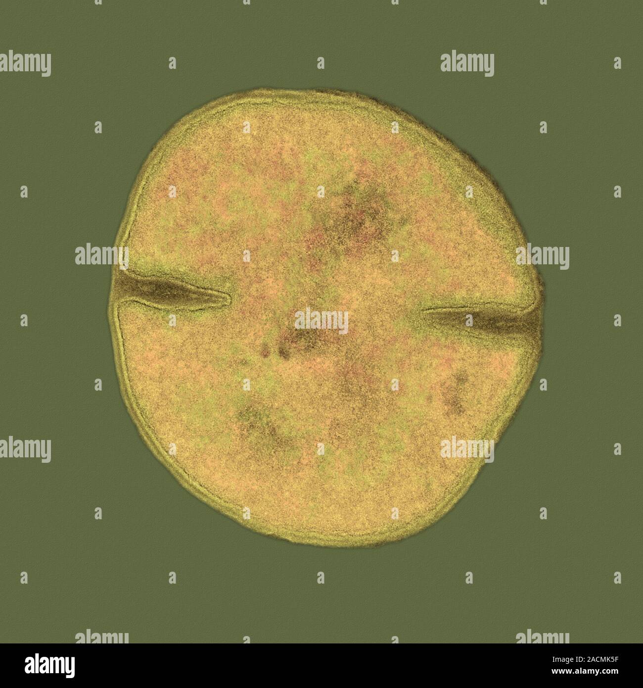 Staphylococcus aureus Bacteria. TEM Stock Photo - Alamy