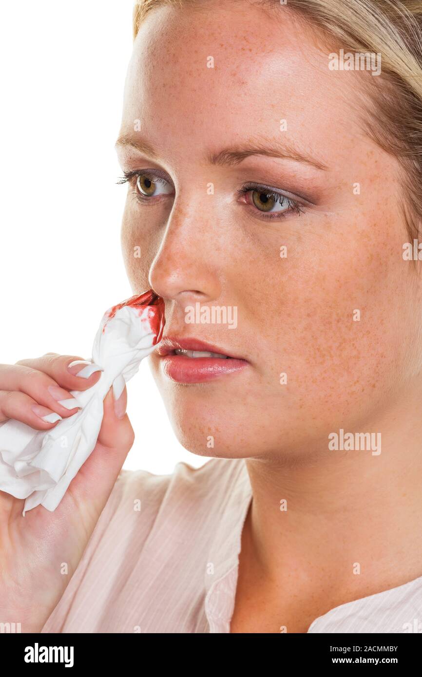 bleed woman with noses Stock Photo - Alamy