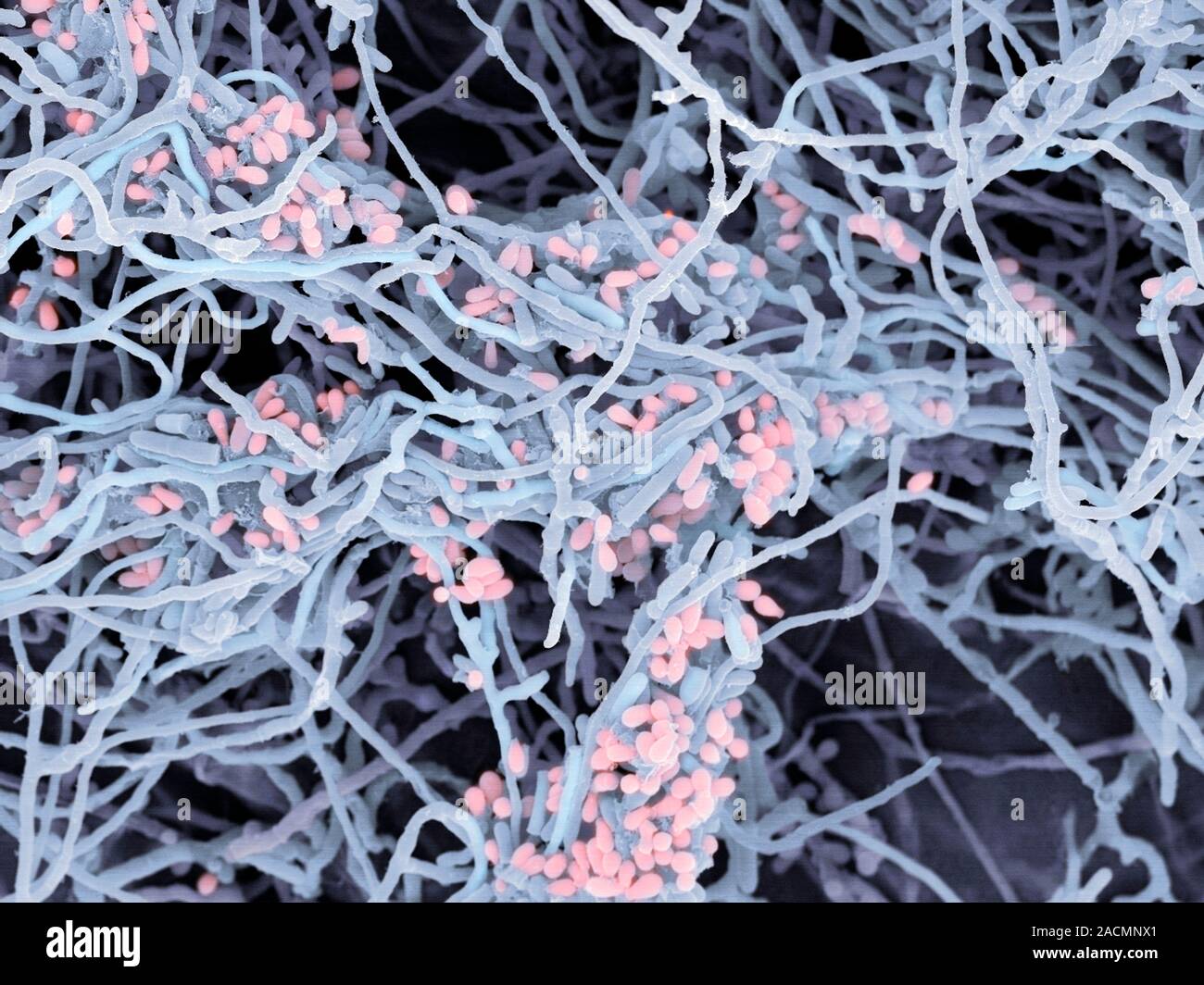 Dermatophyte fungus. Coloured scanning electron micrograph (SEM) of the ...