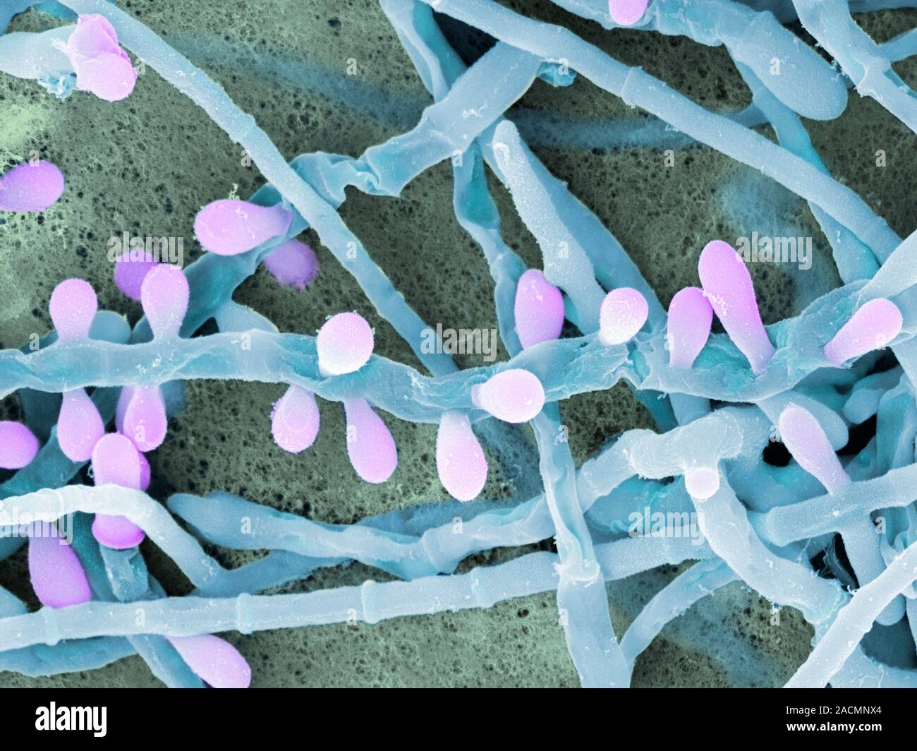 Dermatophyte fungus. Coloured scanning electron micrograph (SEM) of the ...