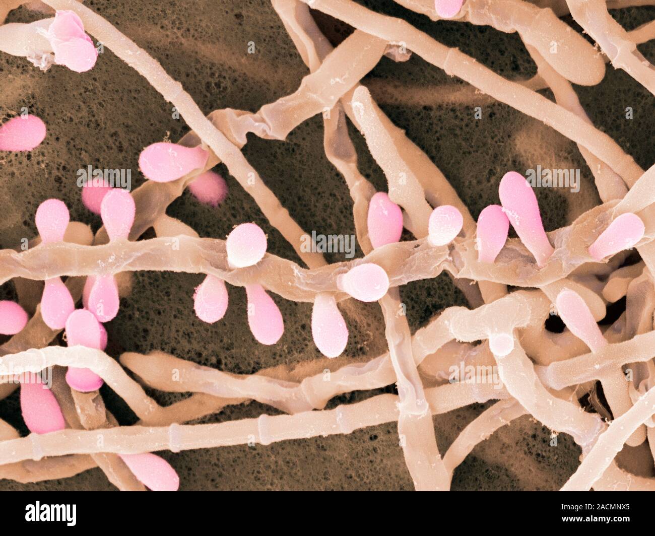 Dermatophyte fungus. Coloured scanning electron micrograph (SEM) of the ...