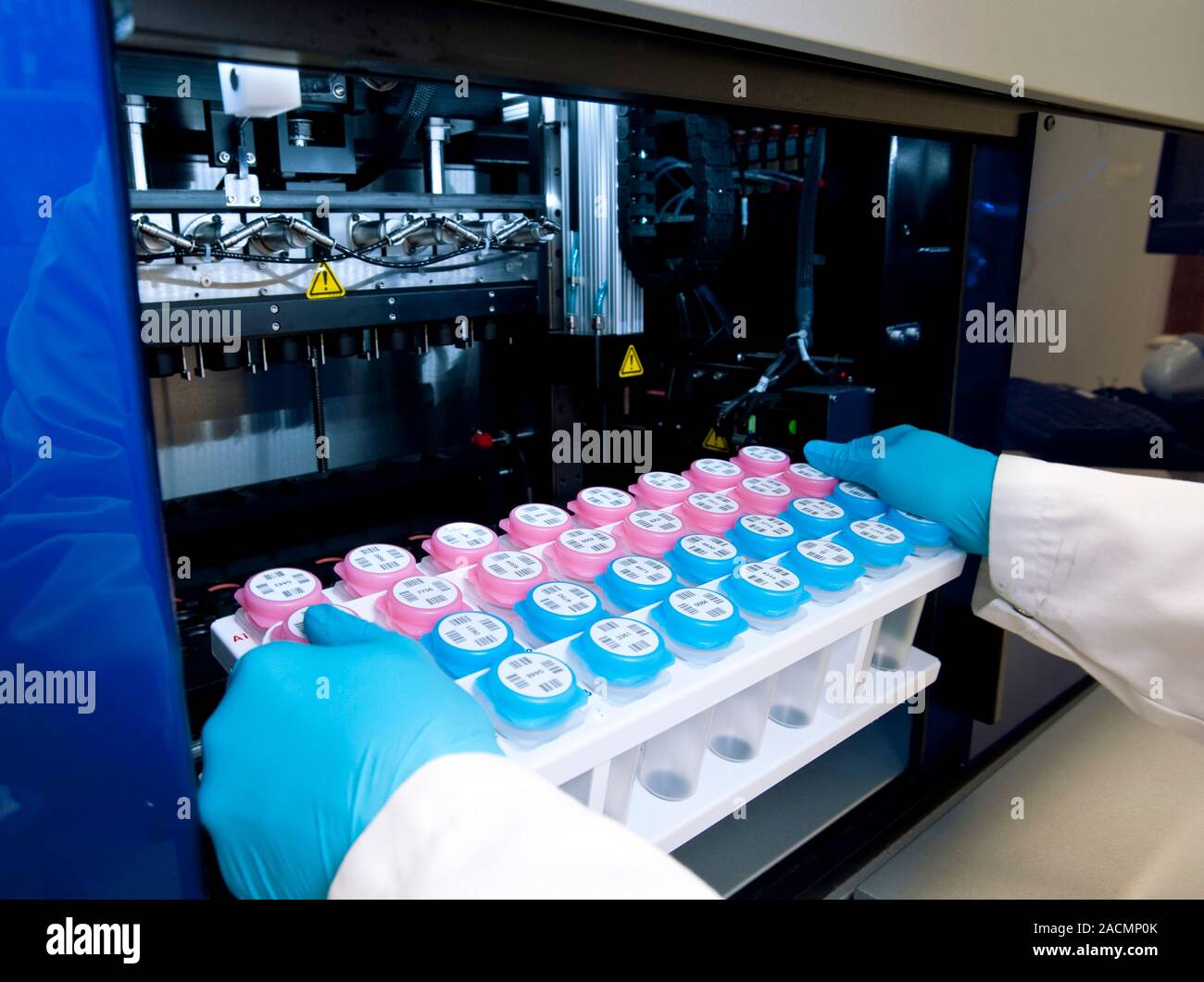 DNA analysis, extraction machine. Hands of a laboratory technician ...
