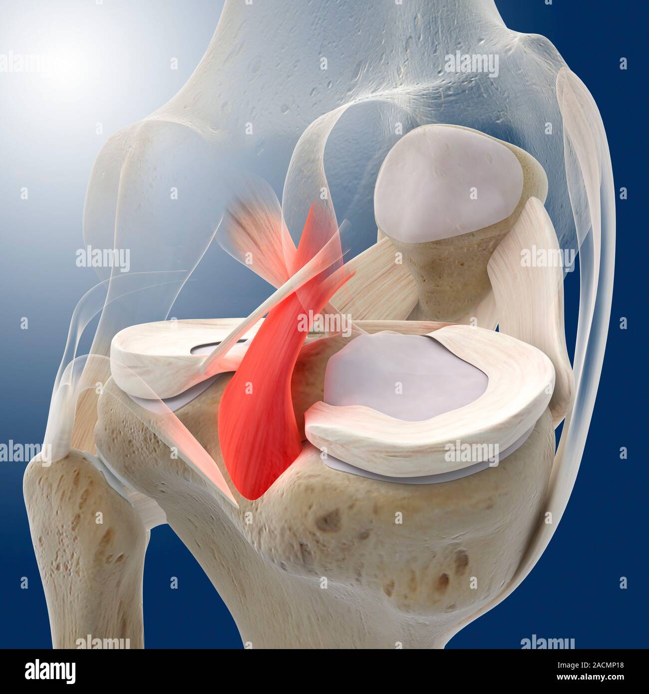 Knee pain, conceptual computer artwork. Inflammation (red) of the ...
