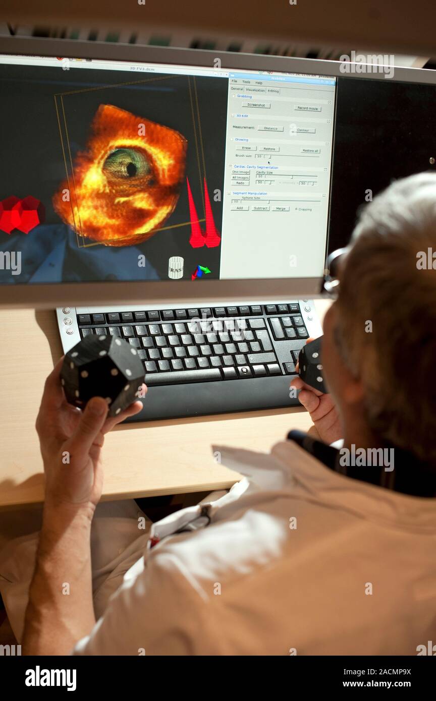 3D ultrasound cardiography. Cardiologist performing a 3D ultrasound ...