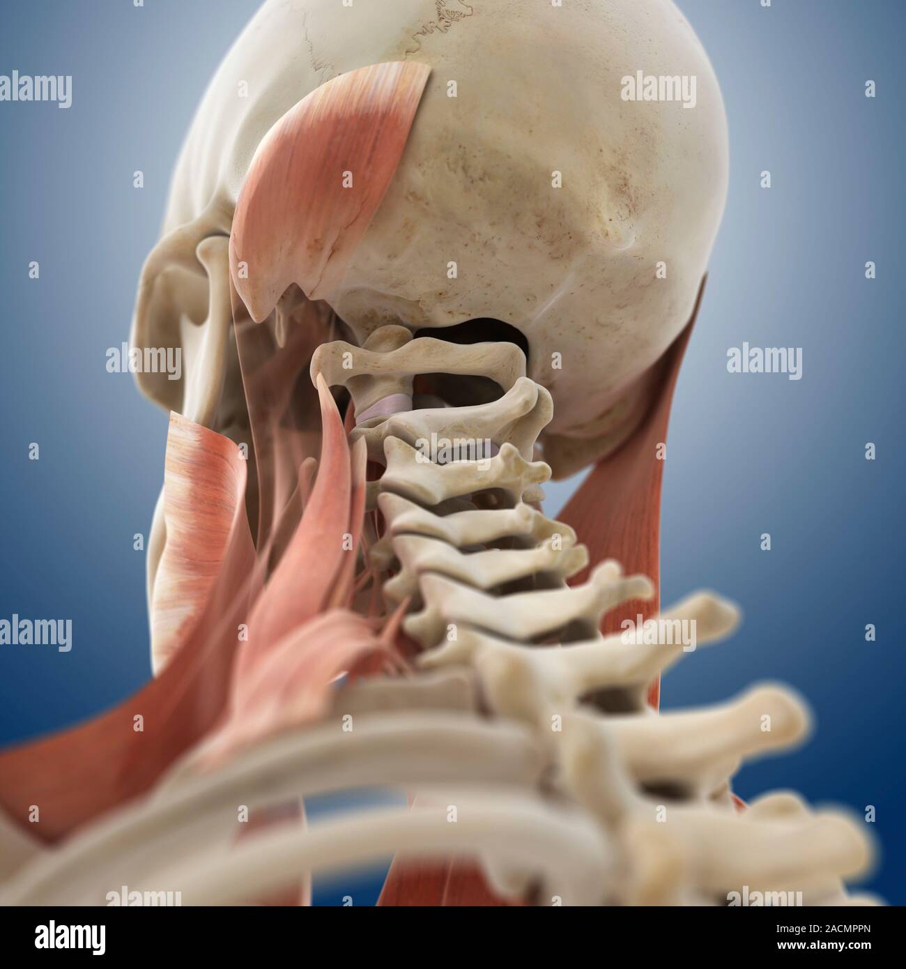 Neck muscles, computer artwork. Attached to the spine are the scalene ...