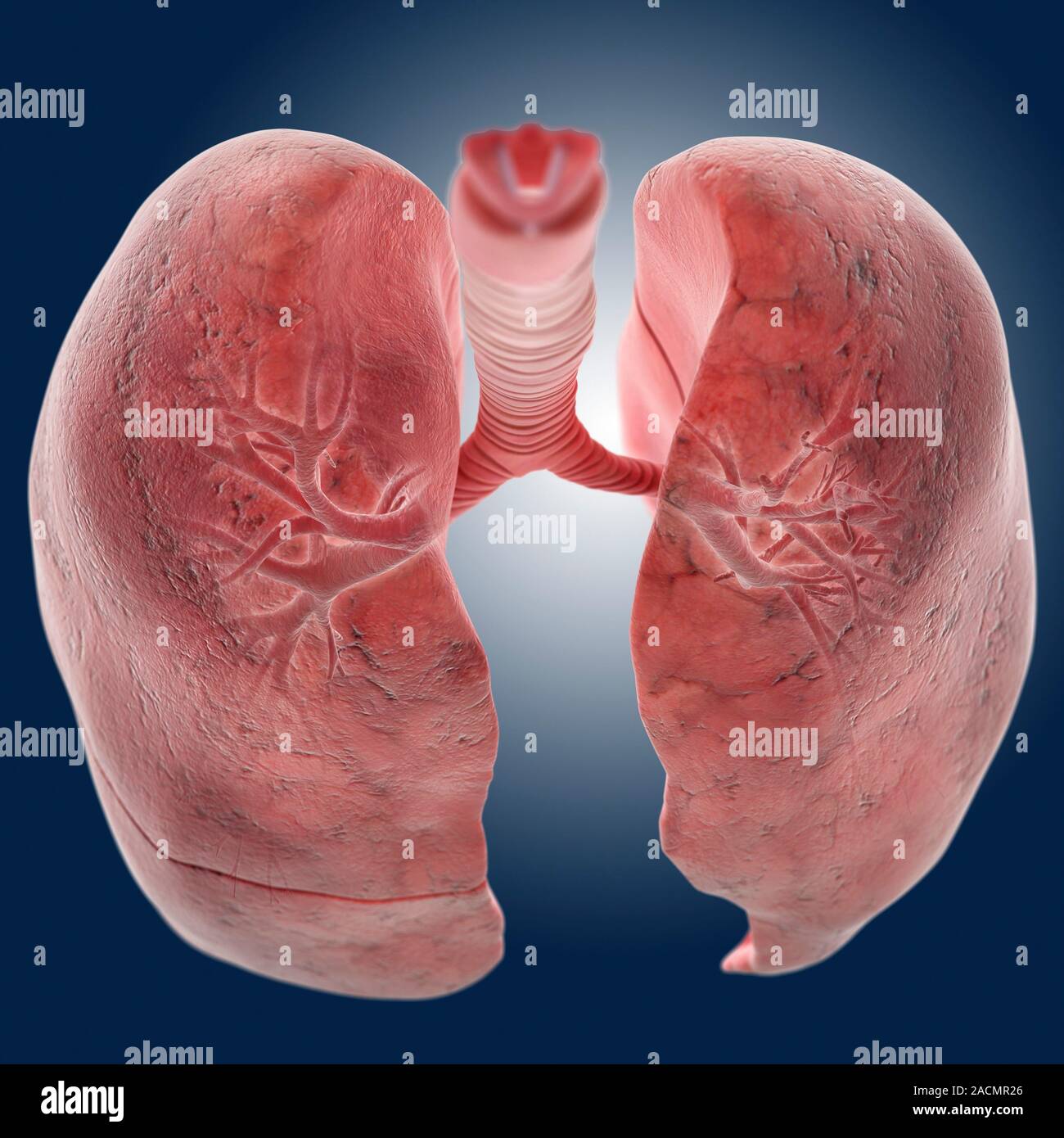 Lungs, computer artwork. At top is the trachea (windpipe), which splits ...