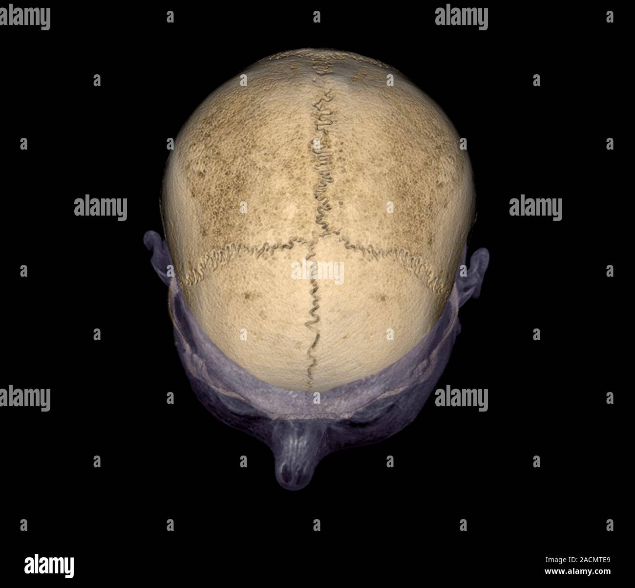 Skull sutures. 3D CT scan of the surface of a 30-year-old's skull ...