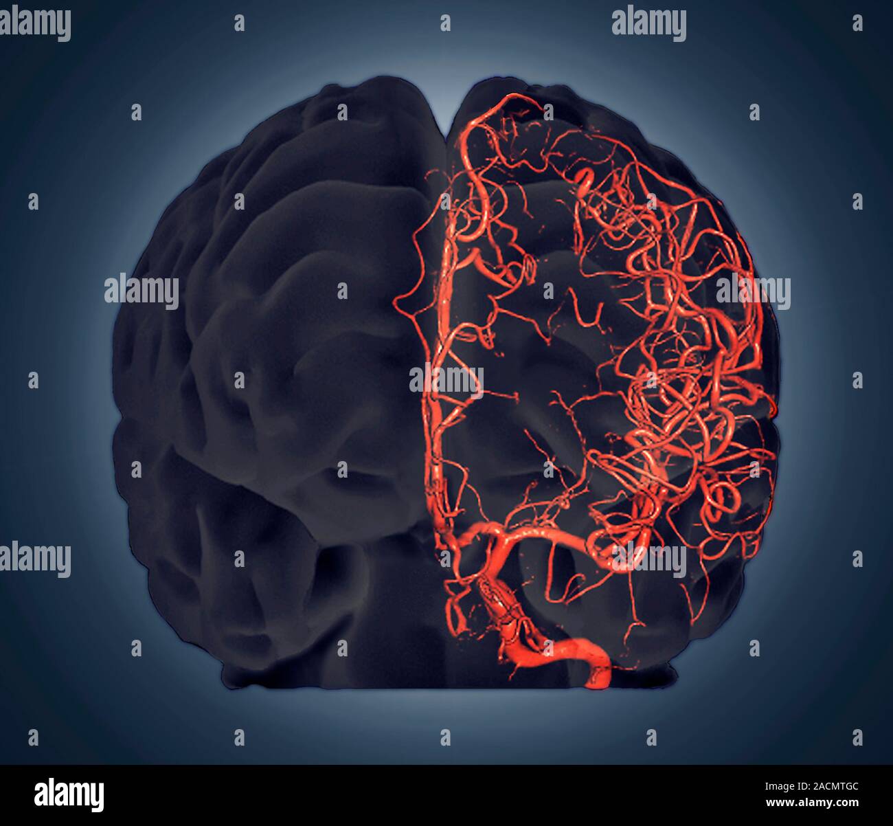 Brain vascular system. Coloured 3D computed tomography (CT) angiogram of the left hemisphere of ...