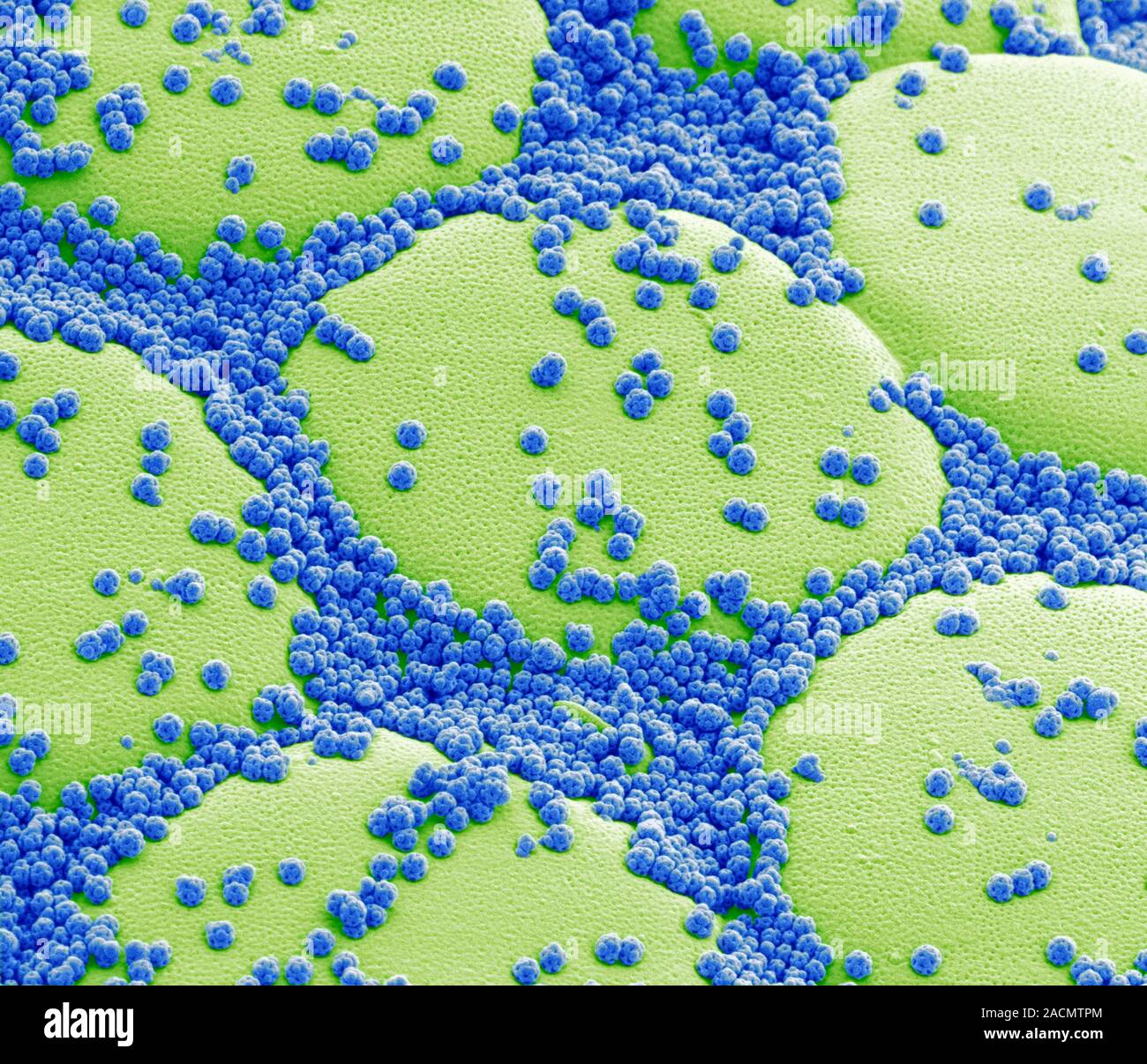 Brochosomes on a leafhopper. Coloured scanning electron micrograph (SEM ...