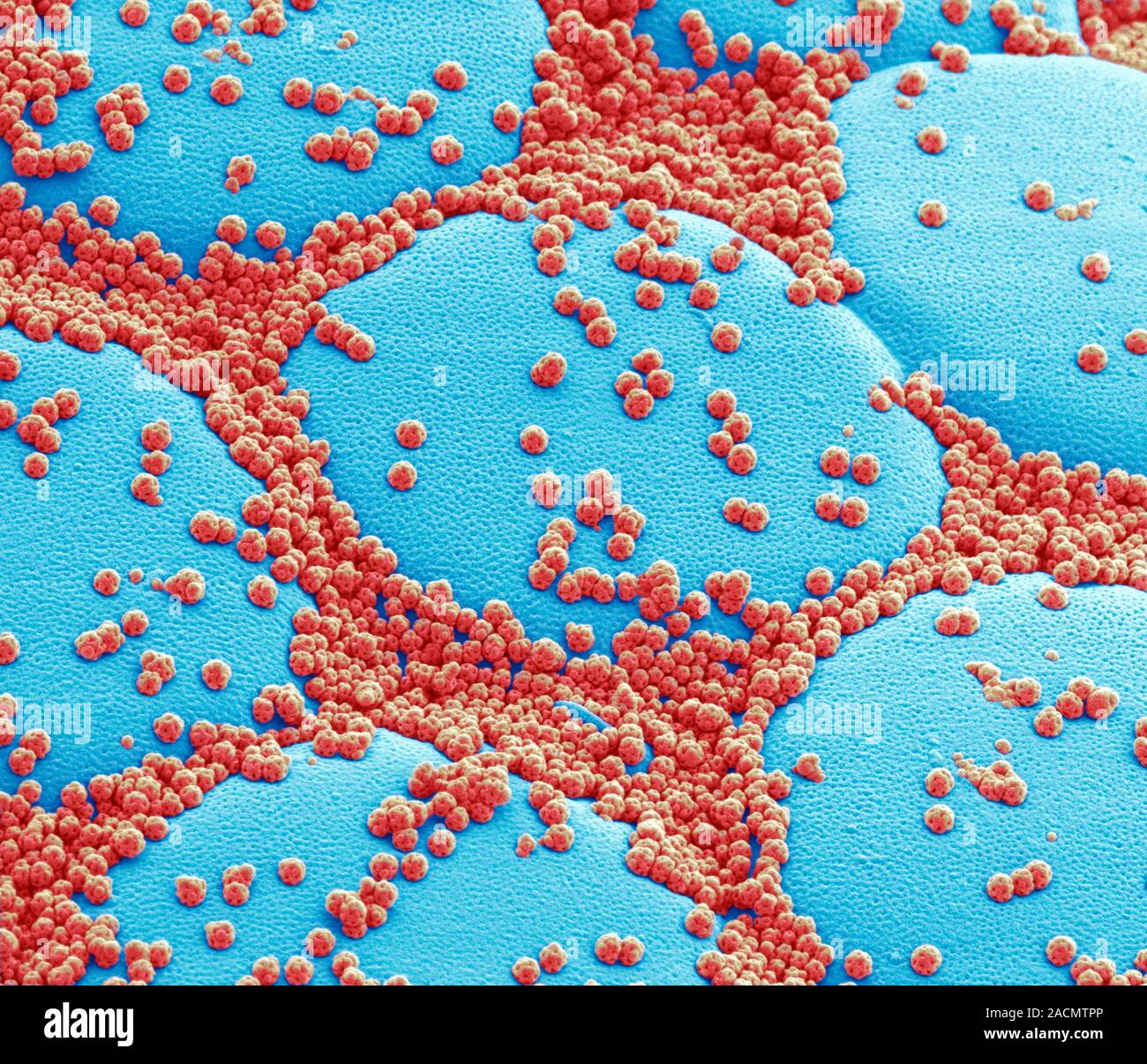 Brochosomes on a leafhopper. Coloured scanning electron micrograph (SEM ...