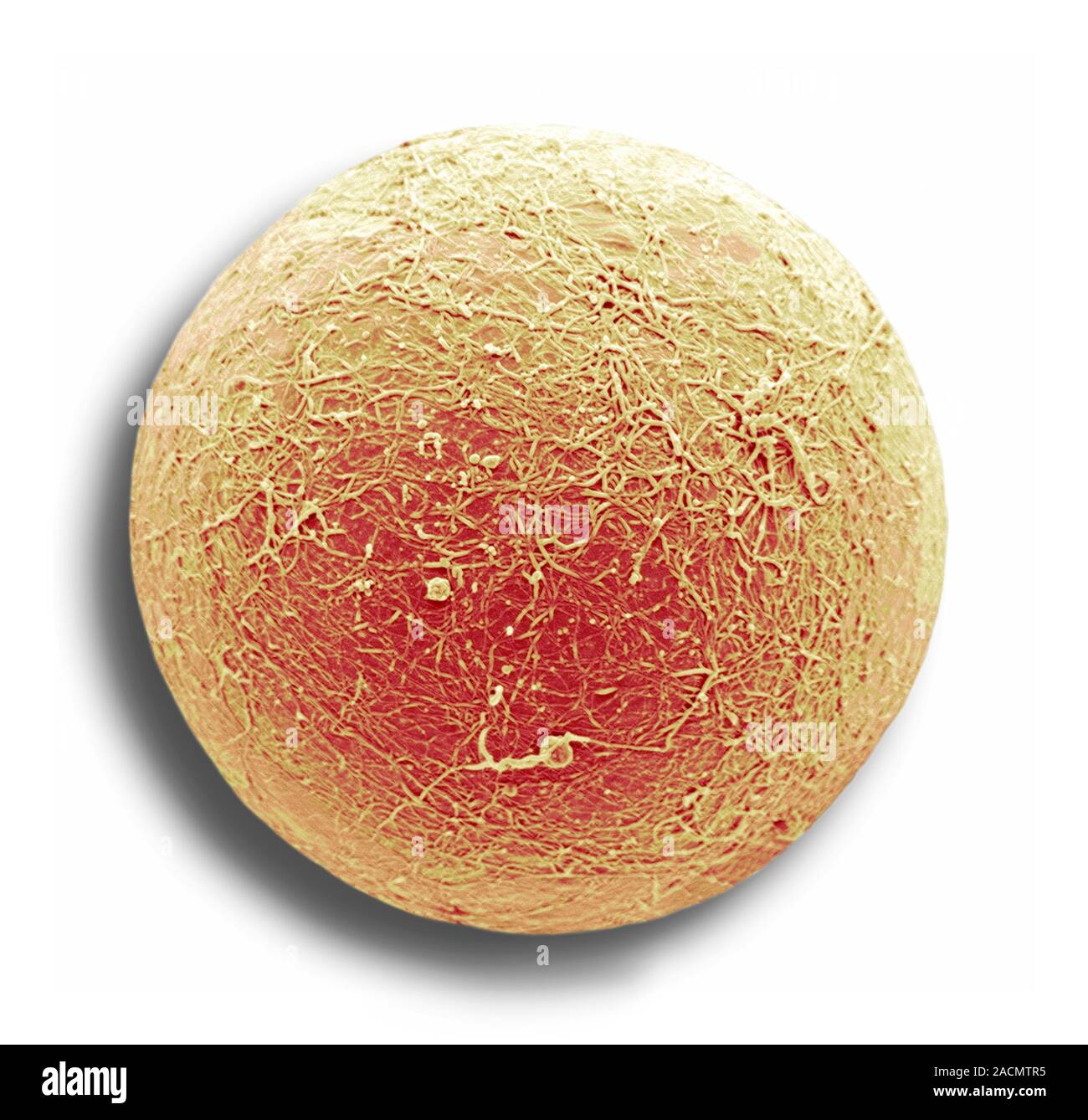 Fat cell. Coloured scanning electron micrograph (SEM) of a single ...