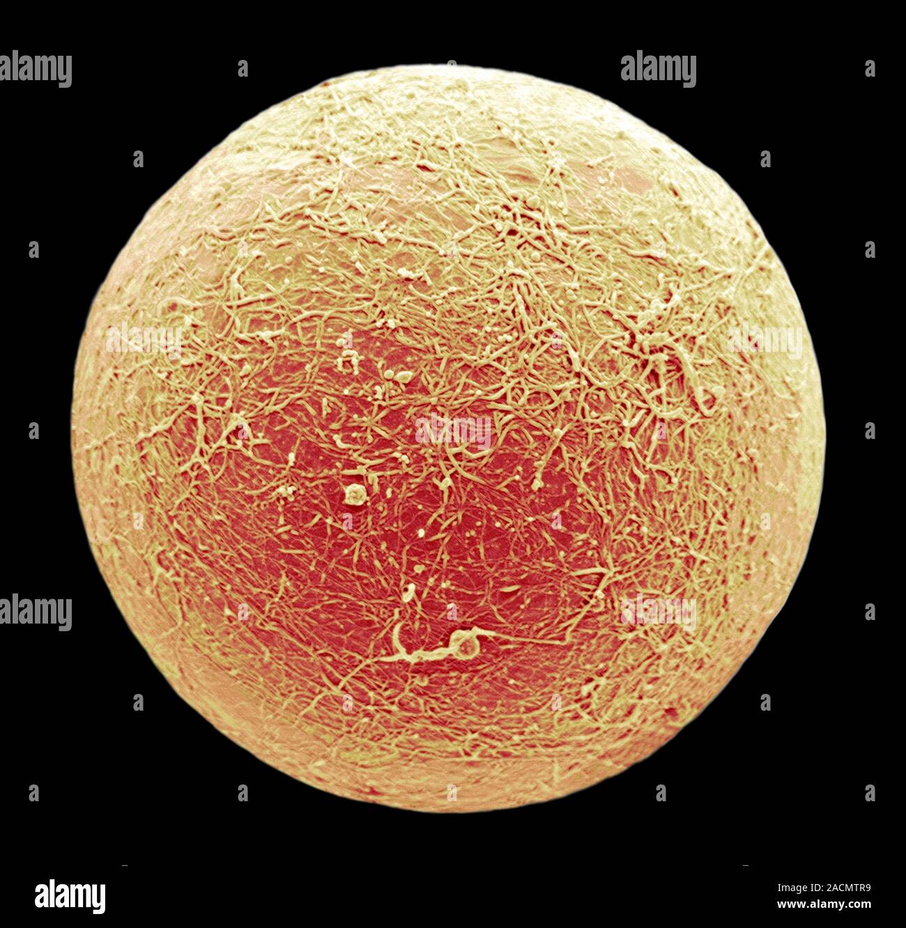 Fat cell. Coloured scanning electron micrograph (SEM) of a single ...