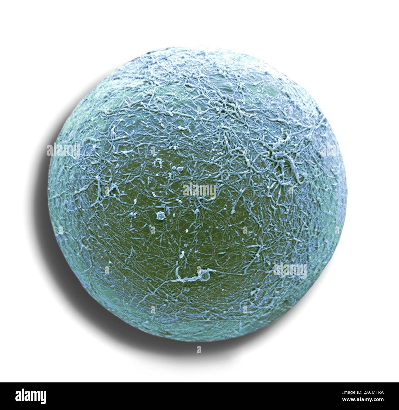Fat cell. Coloured scanning electron micrograph (SEM) of a single ...