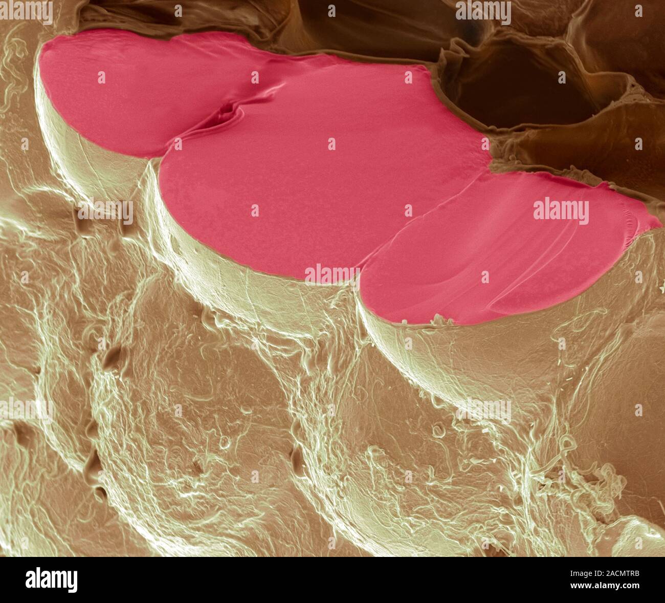 Fat Cells Coloured Scanning Electron Micrograph Sem Of A Section Through Adipose Fat Tissue