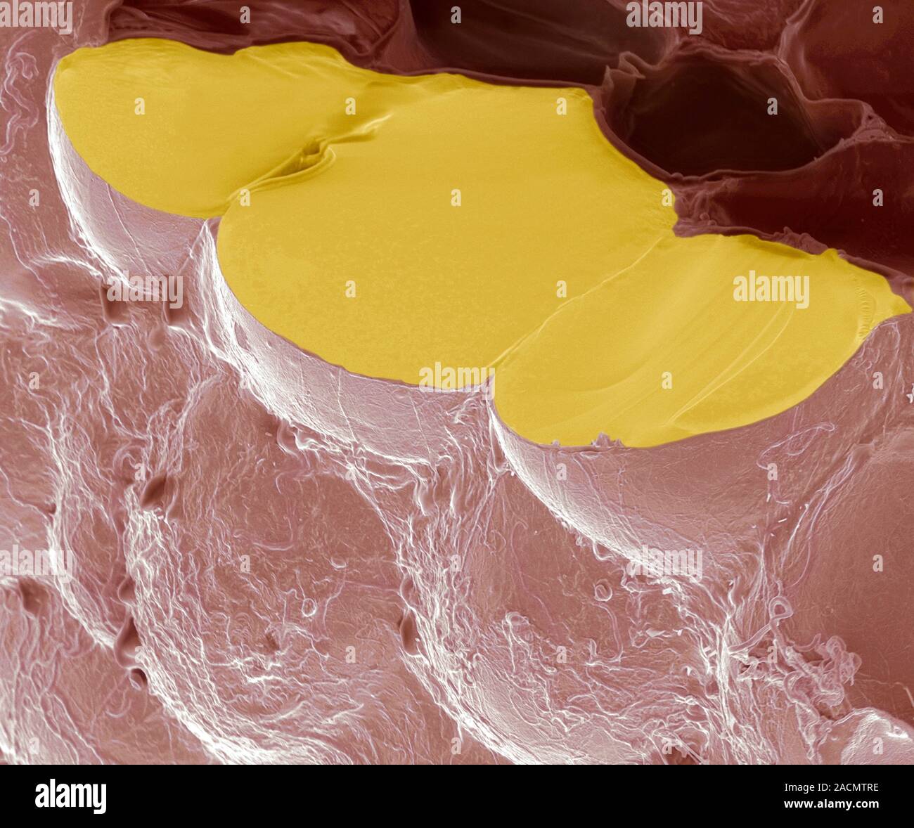 Fat cells. Coloured scanning electron micrograph (SEM) of a section ...