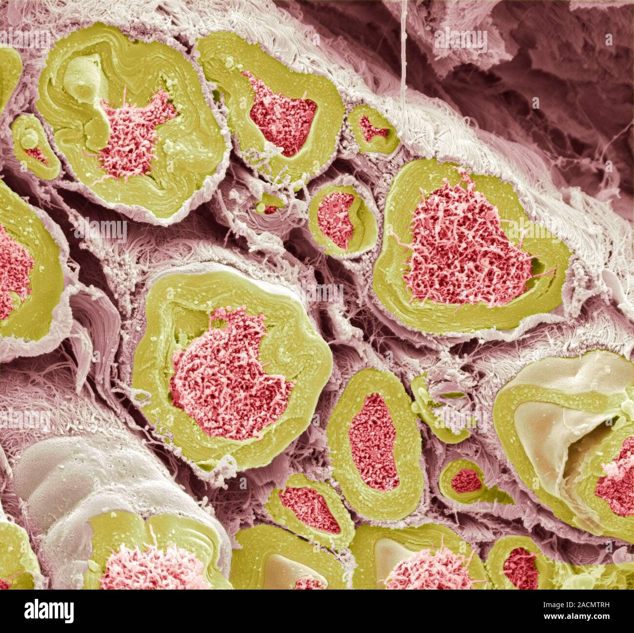 Sciatic Nerve Coloured Scanning Electron Micrograph Sem Of A Section Through A Sciatic Nerve