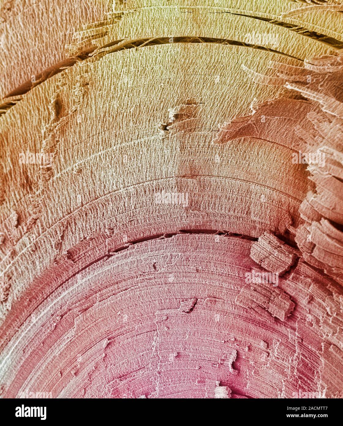 Eye lens. Coloured scanning electron micrograph (SEM) of a section ...