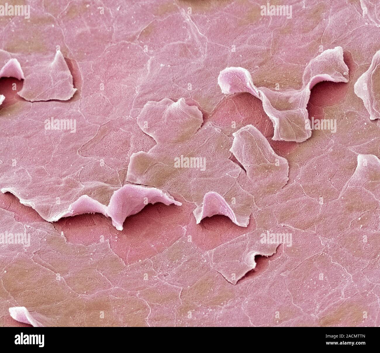Hard palate lining. Coloured scanning electron micrograph (SEM) showing ...