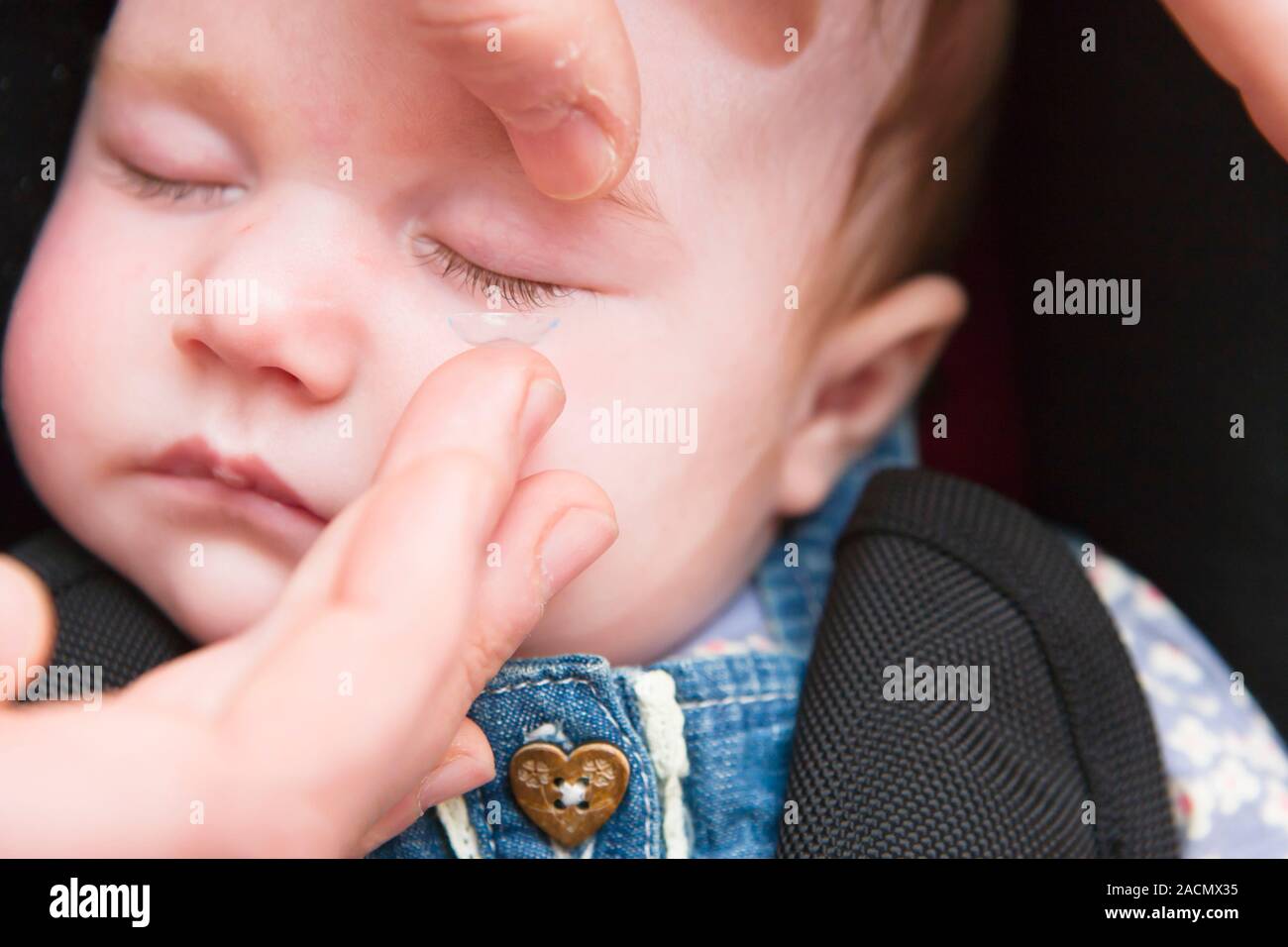 An optometrist ready to place a contact lens onto a baby's eye Stock ...