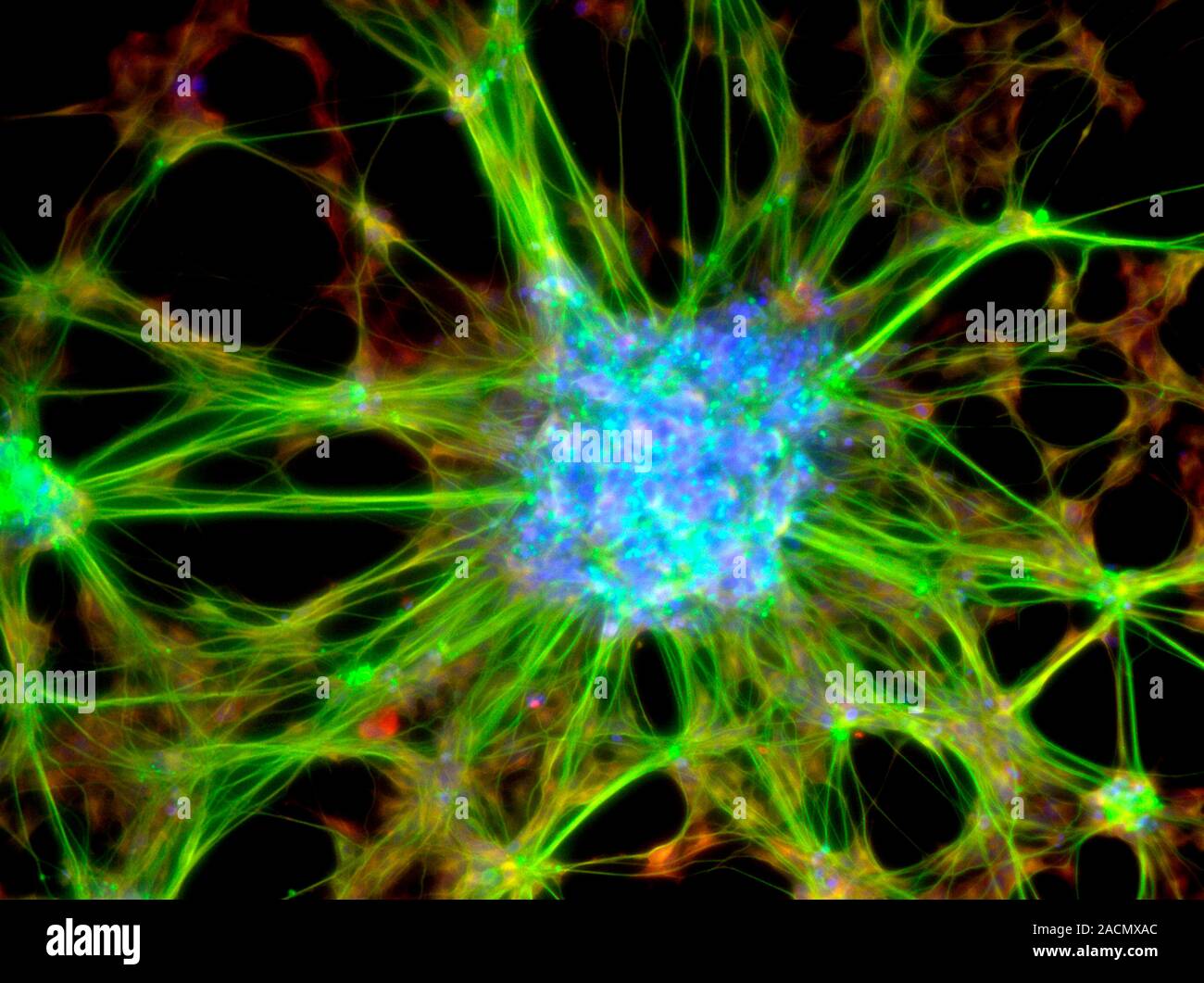 Neural stem cell culture. Fluorescent light micrograph of a group of neural stem cells ...