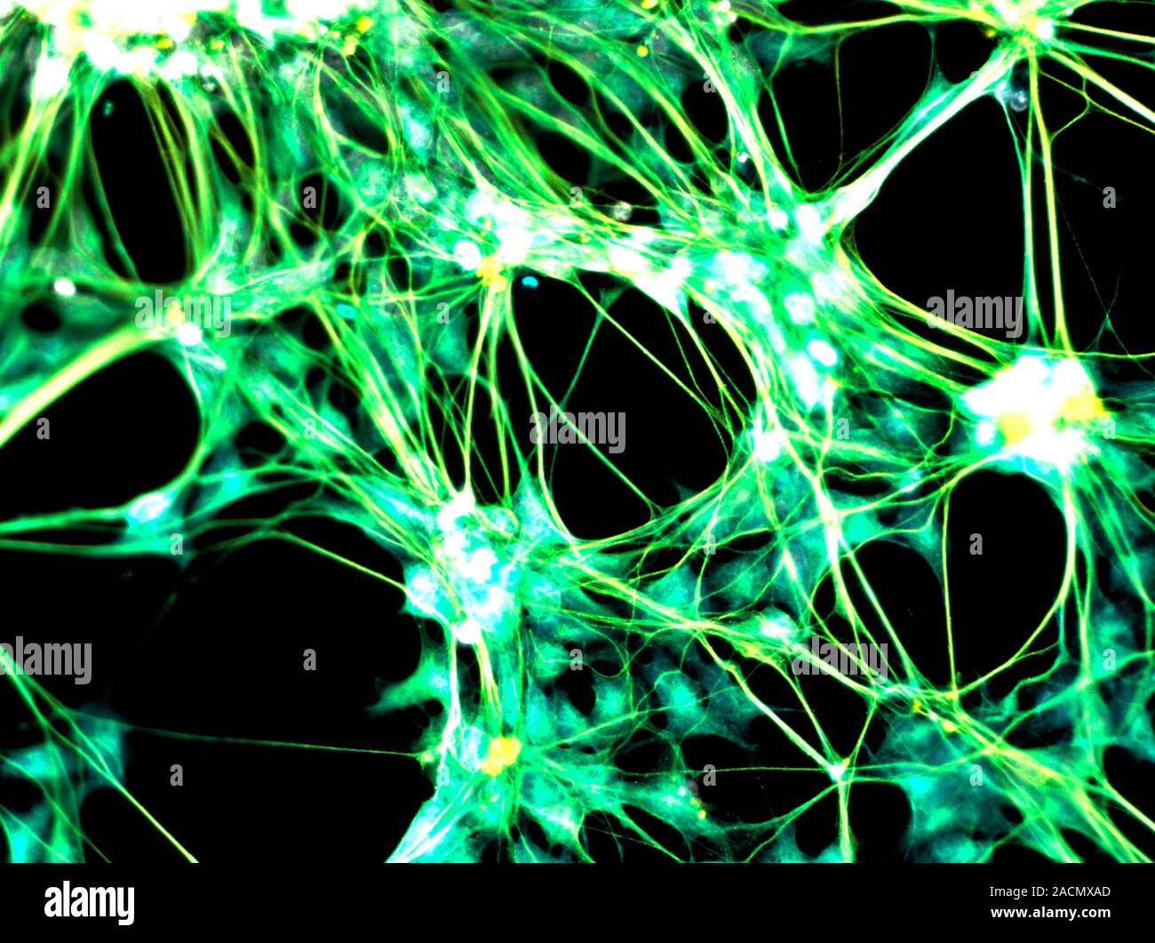 Neural stem cell culture. Fluorescent light micrograph of groups of ...