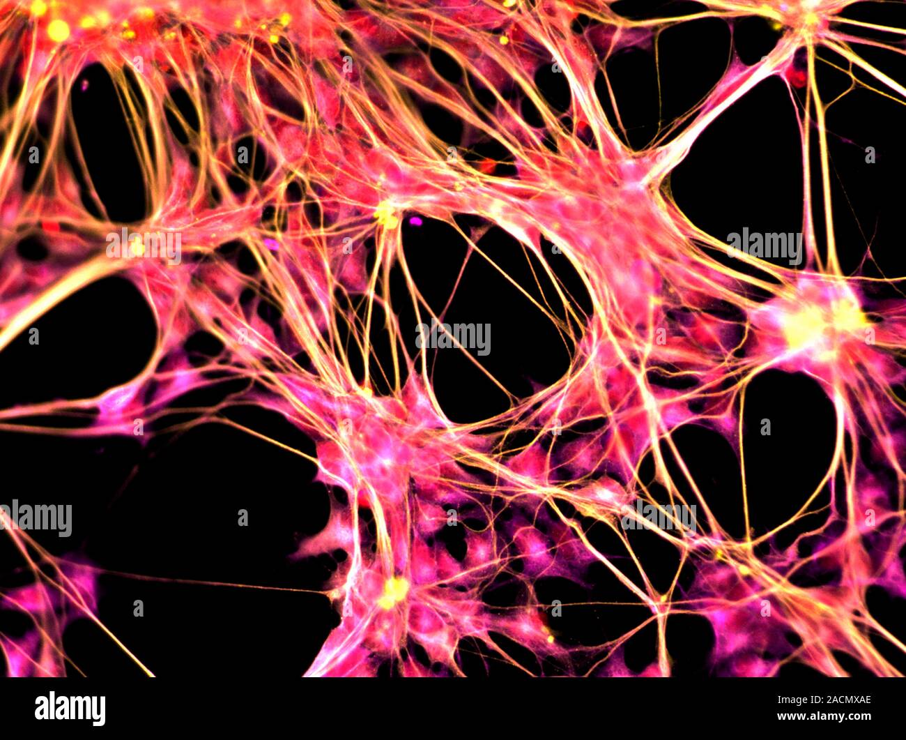 Neural stem cell culture. Fluorescent light micrograph of groups of ...