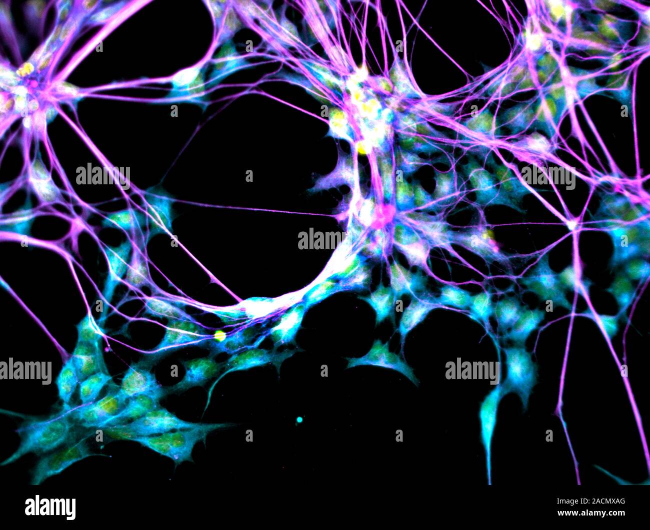 Neural stem cell culture. Fluorescent light micrograph of groups of ...