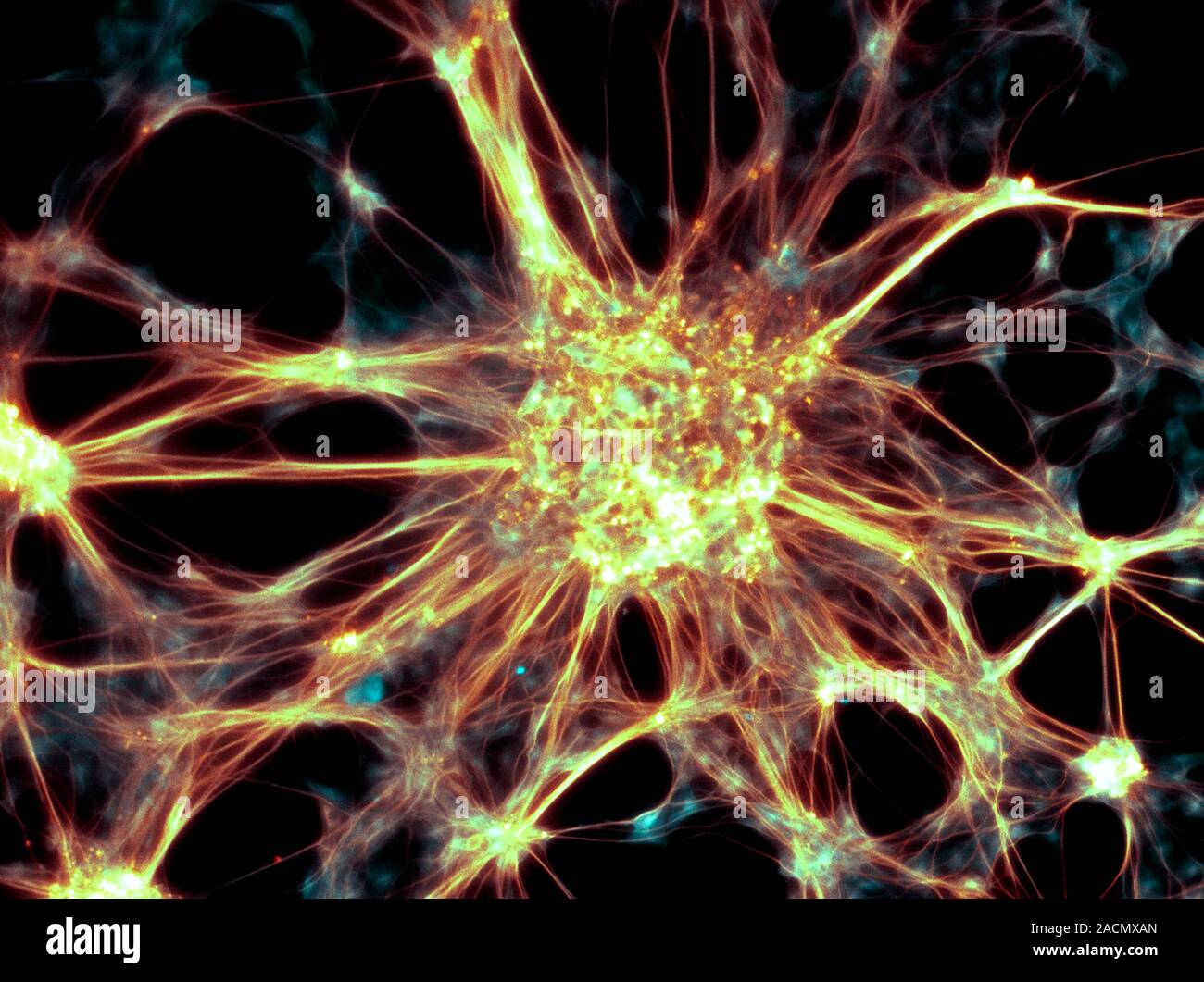 Neural stem cell culture. Fluorescent light micrograph of a group of ...