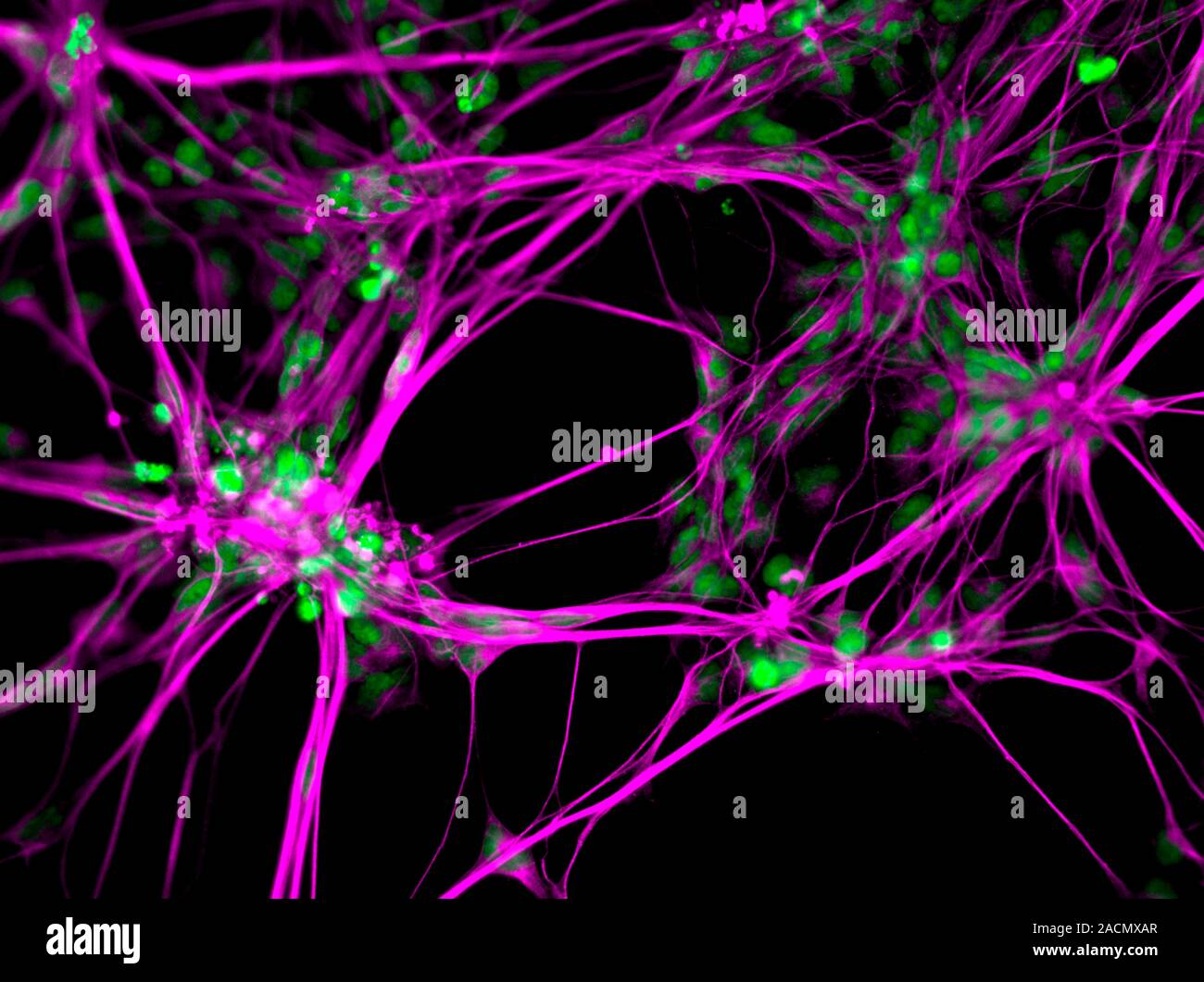 Neural stem cell culture. Fluorescent light micrograph of groups of ...