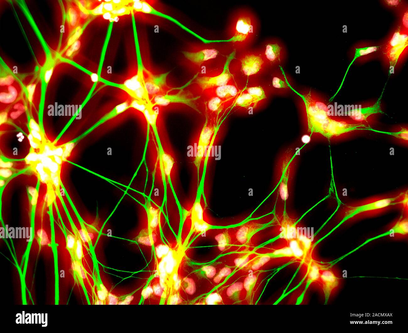 Neural stem cell culture. Fluorescent light micrograph of groups of ...