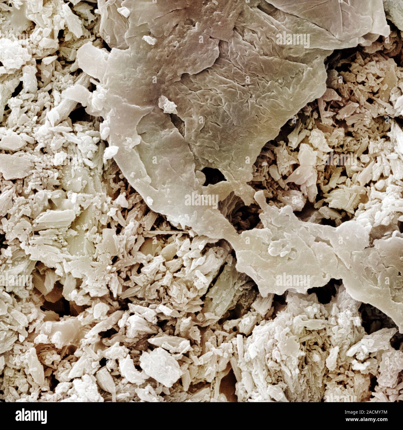 Gypsum crystals. Coloured scanning electron micrograph (SEM) of ...
