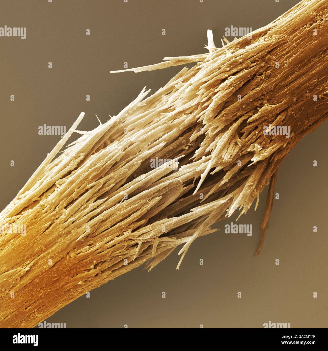 Damaged human hair shaft, coloured scanning electron micrograph (SEM ...
