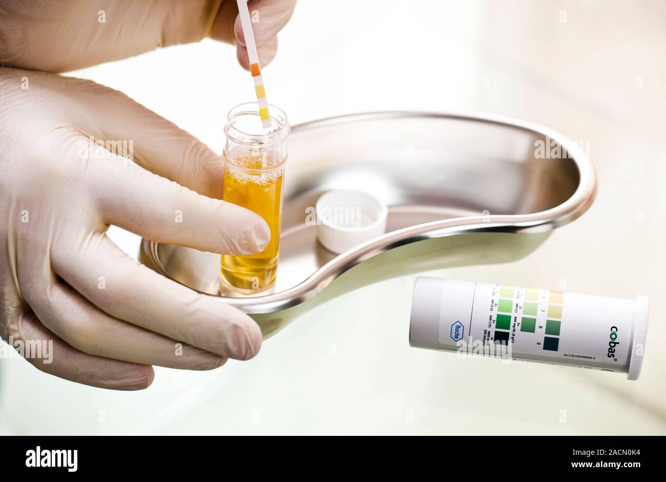 Urine test. Urine test strip being dipped in a urine sample. This strip ...