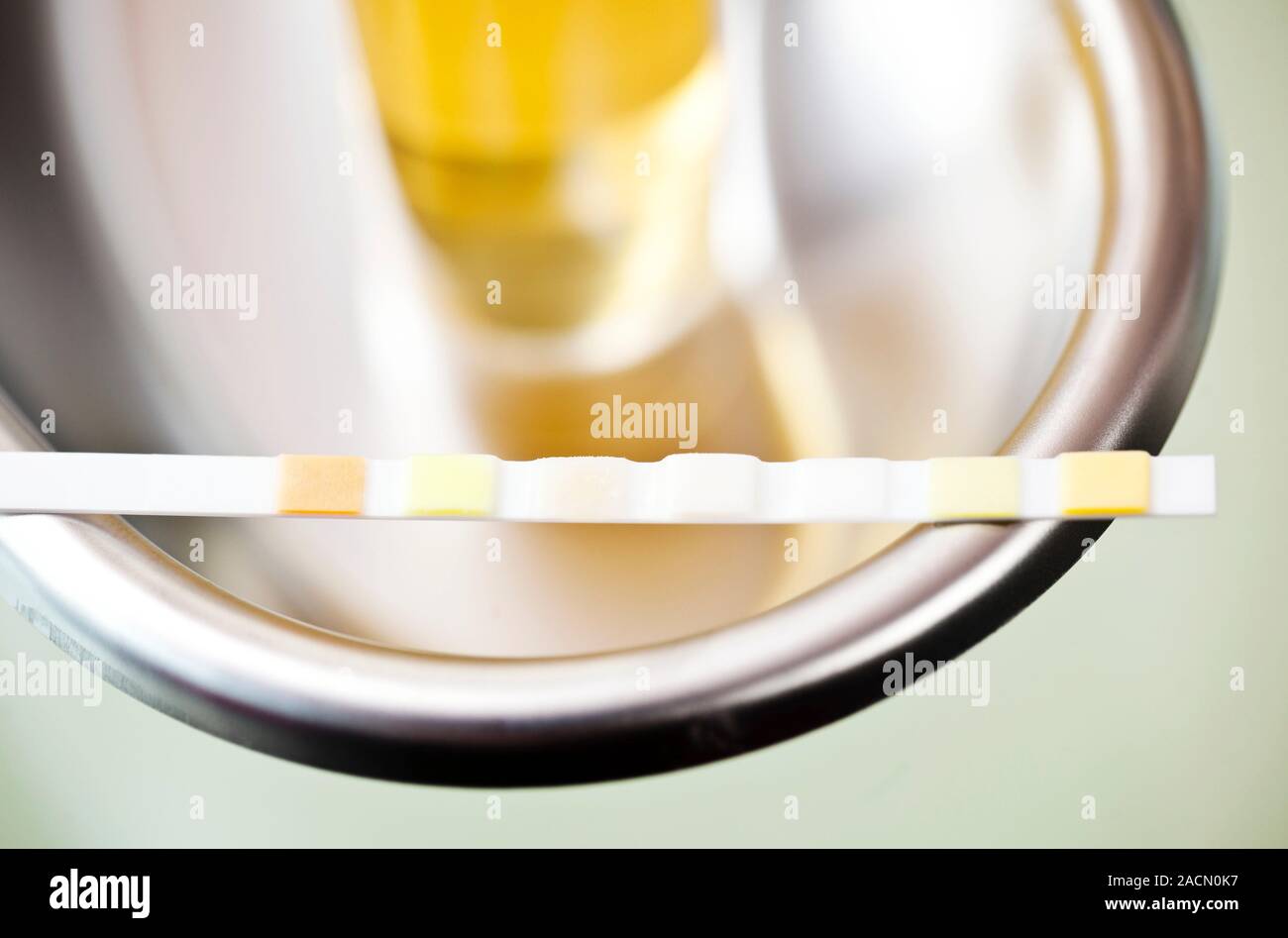 Urine test. Close-up of a urine multi-test strip with the sample bottle ...