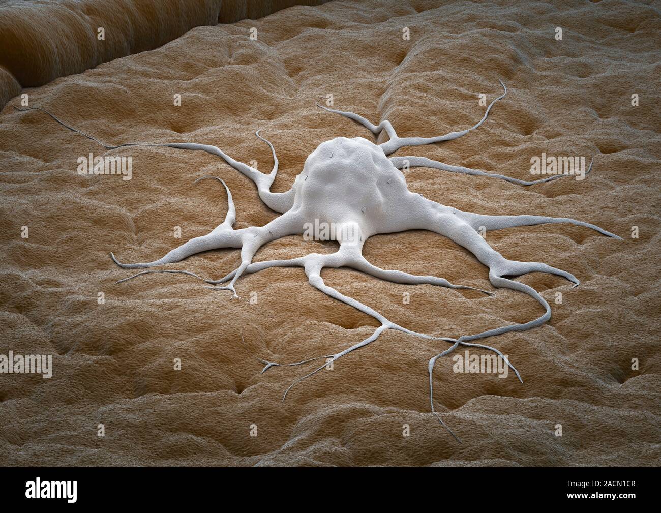 Cancer cell. Computer artwork of a single typical cancer cell in the ...