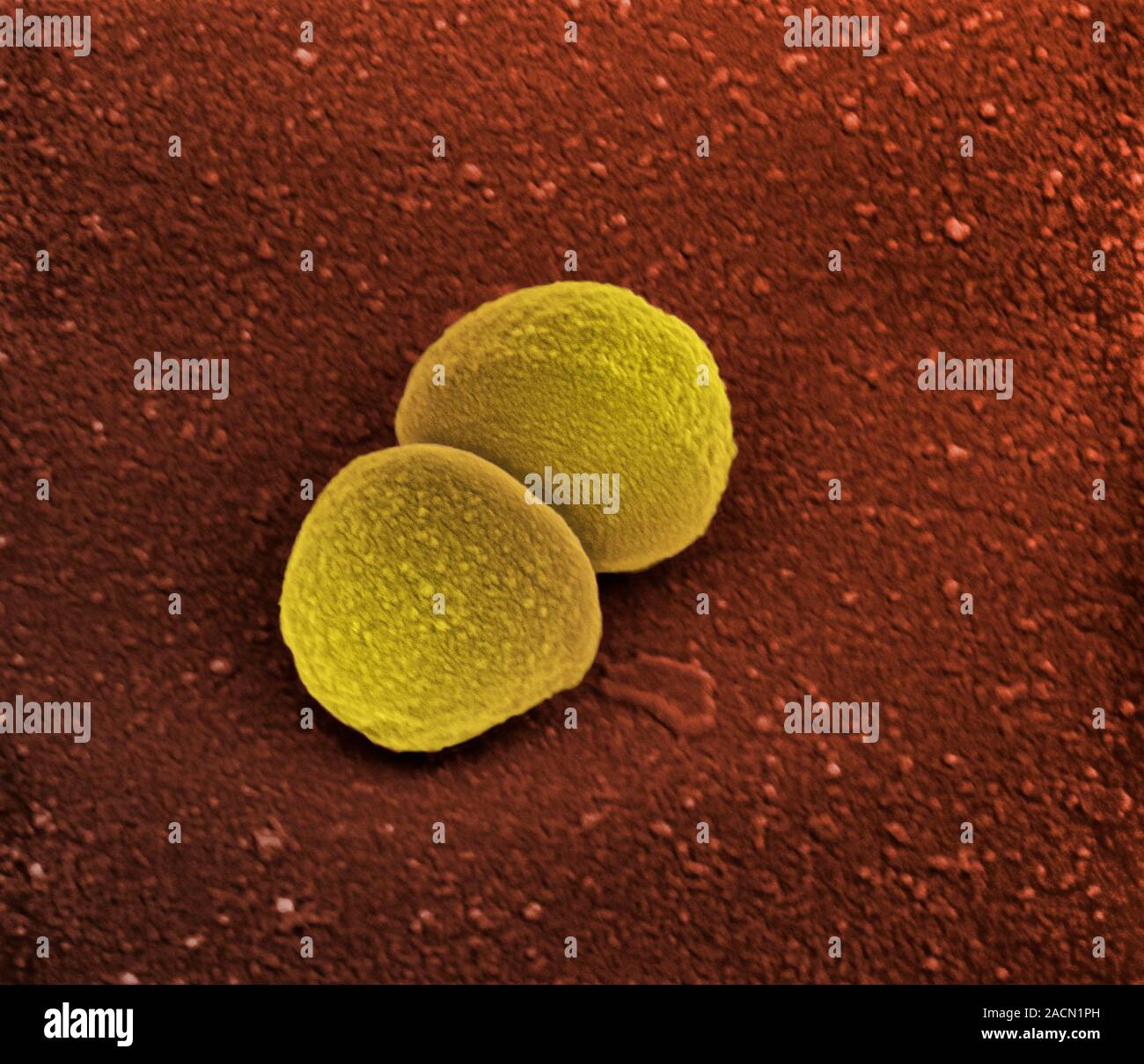 Staphylococcus aureus bacteria. Coloured scanning electron micrograph ...