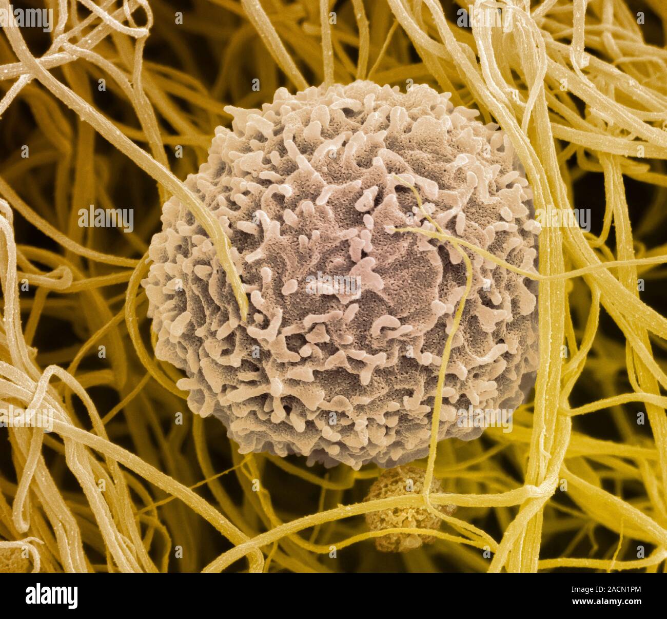 T lymphocyte. Coloured scanning electron micrograph (SEM) of a T ...