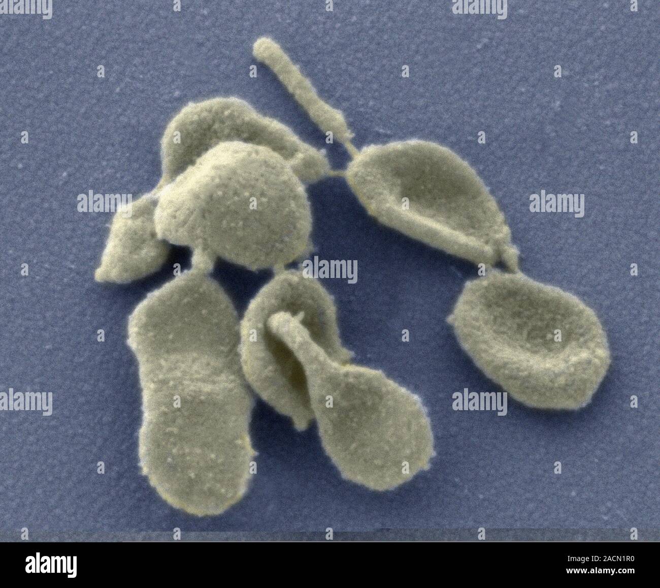Mycoplasma genitalium. Coloured scanning electron micrograph (SEM) of a ...