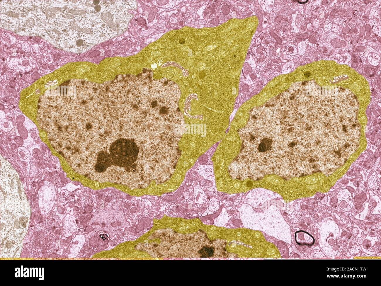 Brain cells. Transmission electron micrograph (TEM) of a section ...