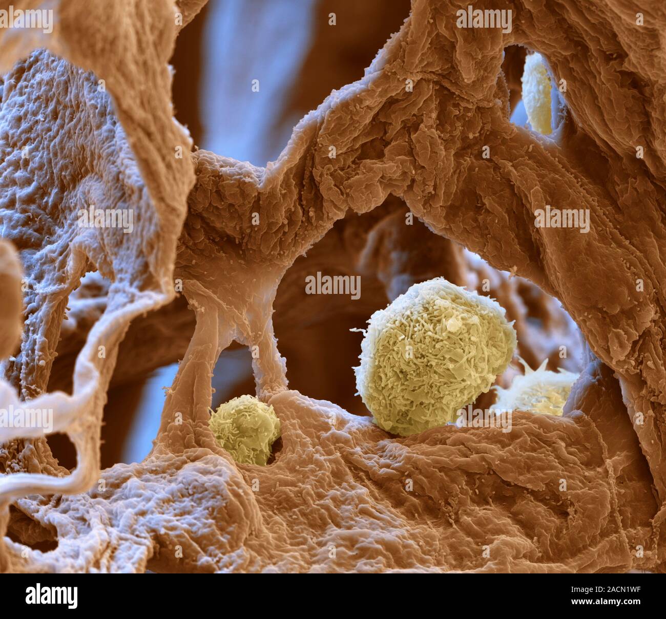 Alveolar macrophages. Coloured scanning electron micrograph (SEM) of ...